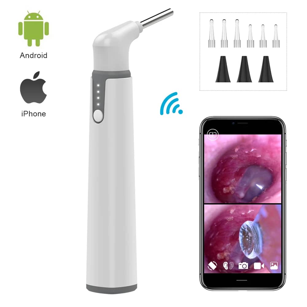 Otoscope smart led - Medicaldz